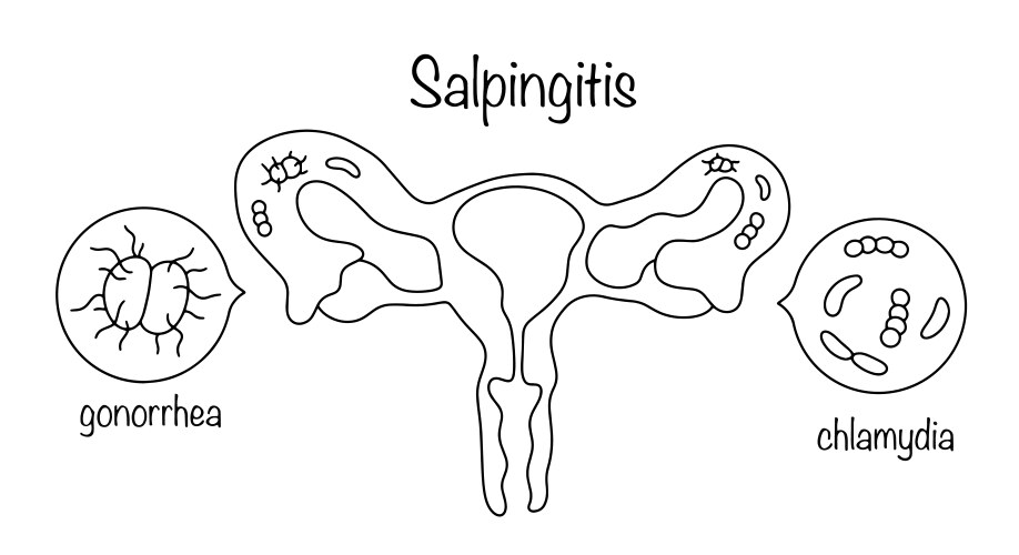 Transmit Vector Images (over 11,000)