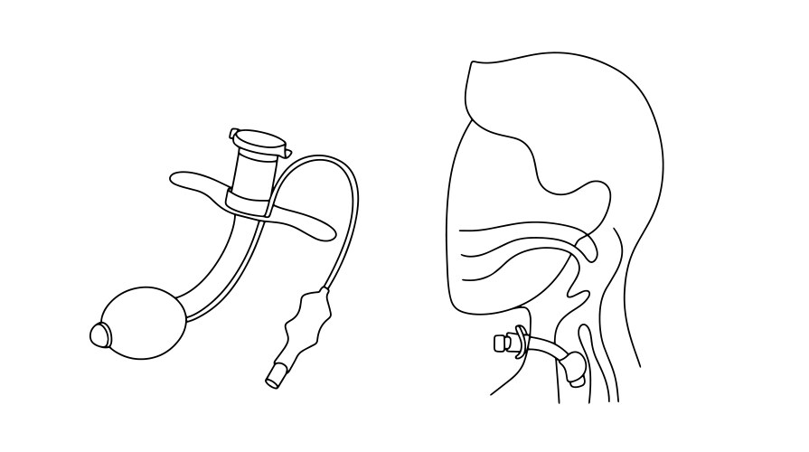 Artificial Breathing Vector Images (over 450)