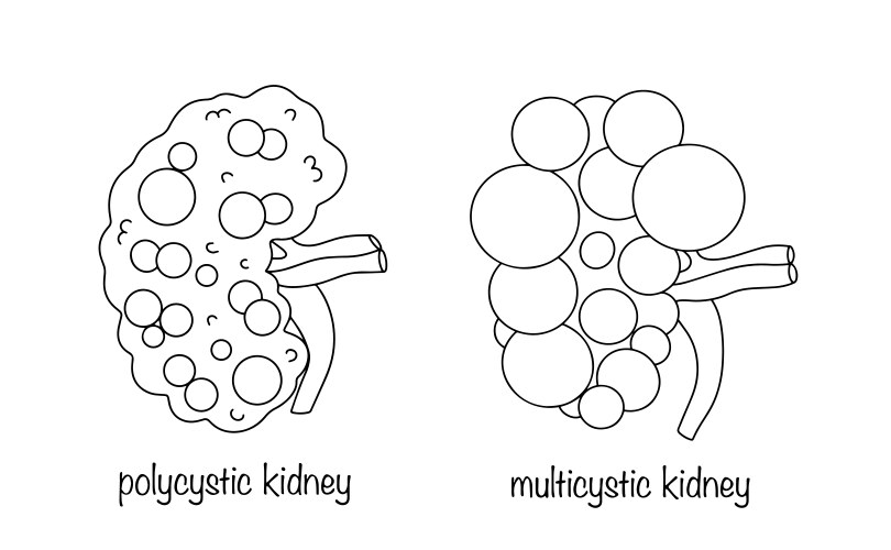 Kidney Vector Images (over 22,000)