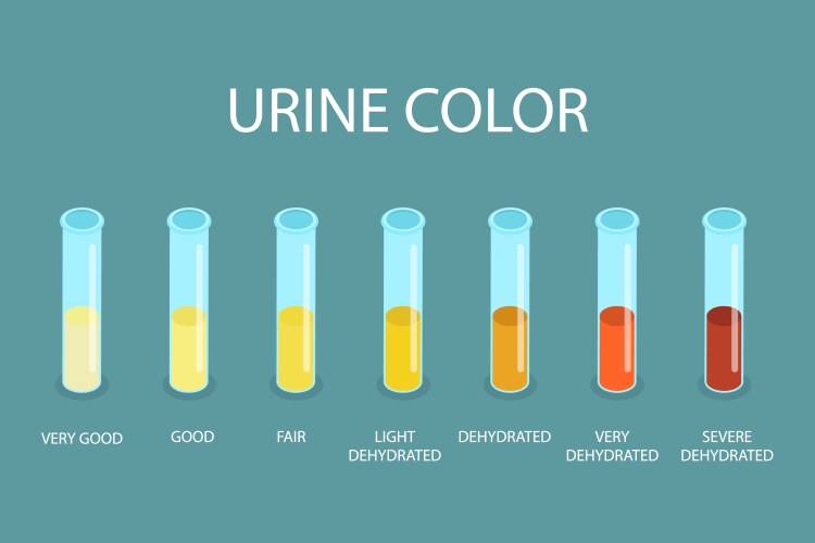 Urine Color Chart - Hydration Test – Royalty-Free Vector | VectorStock