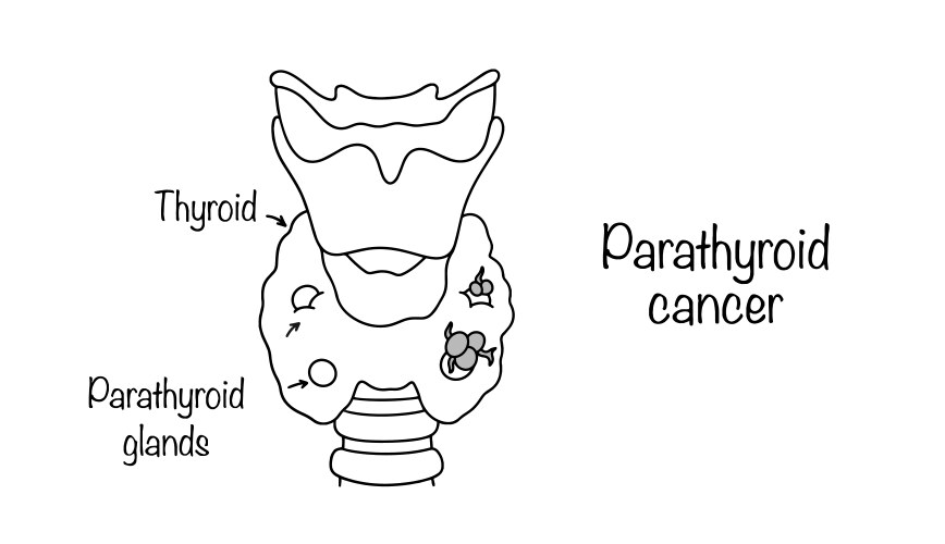 Parathyroid Hormone Vector Images (over 560)