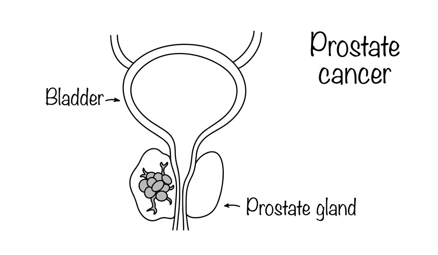 Prostate Vector Images (over 5,600)