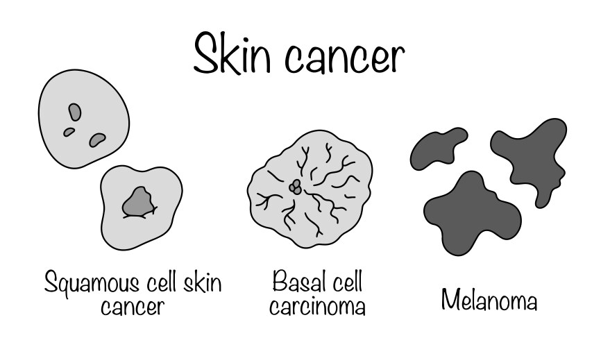 Skin Cancer Vector Images (over 4,000)
