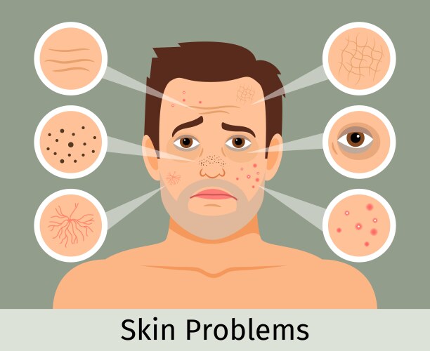 Male face skin problems Royalty Free Vector Image