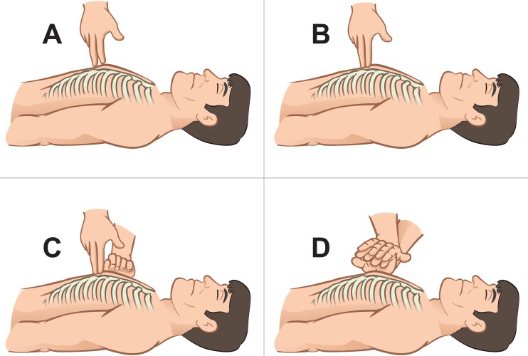 Cpr Vector Images (over 1,400)