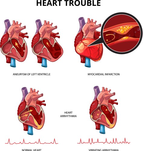 Heart Disease Vector Images (over 42,000)