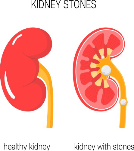 Anatomy kidney cross section showing the major Vector Image