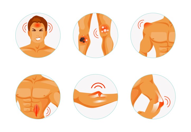 Shoulder Dislocation Vector Images (66)