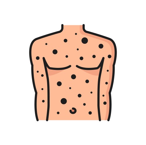 Red Rash Vector Images (over 2,800)
