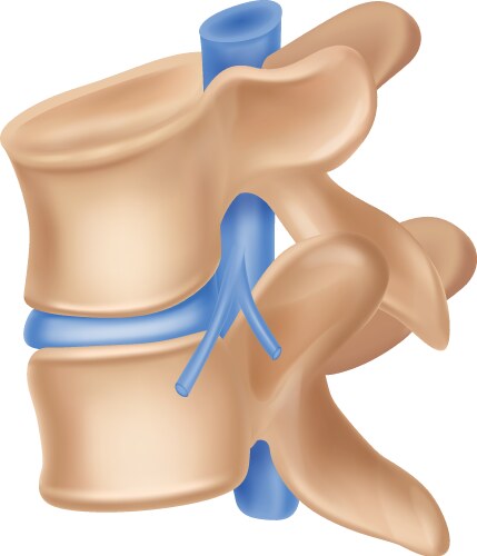 Anatomy spinal hernia infographics Royalty Free Vector Image Anatomy spinal hernia infographics Royalty Free Vector Image