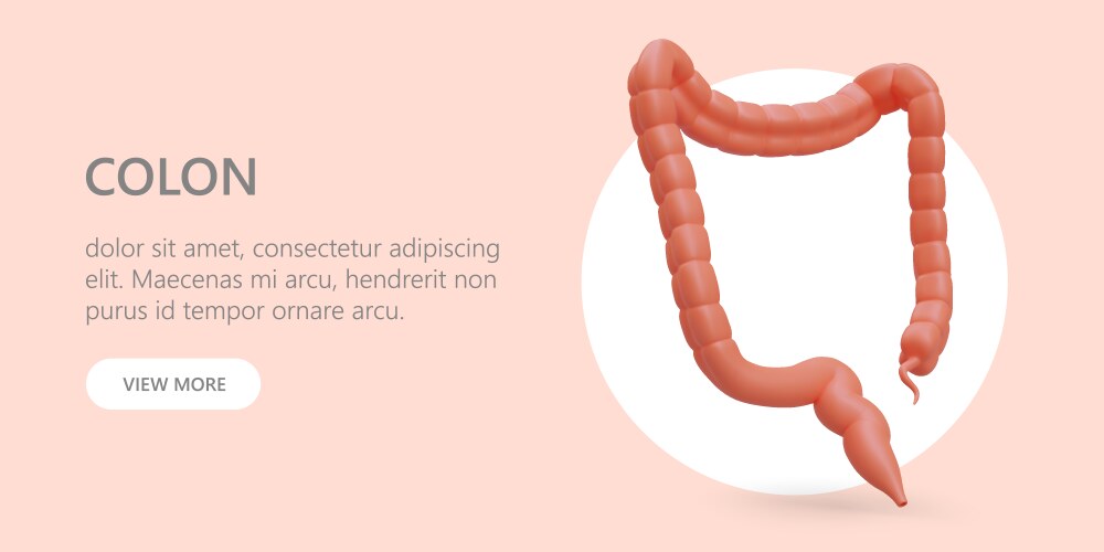 Colon Cancer Vector Images (over 1,700)