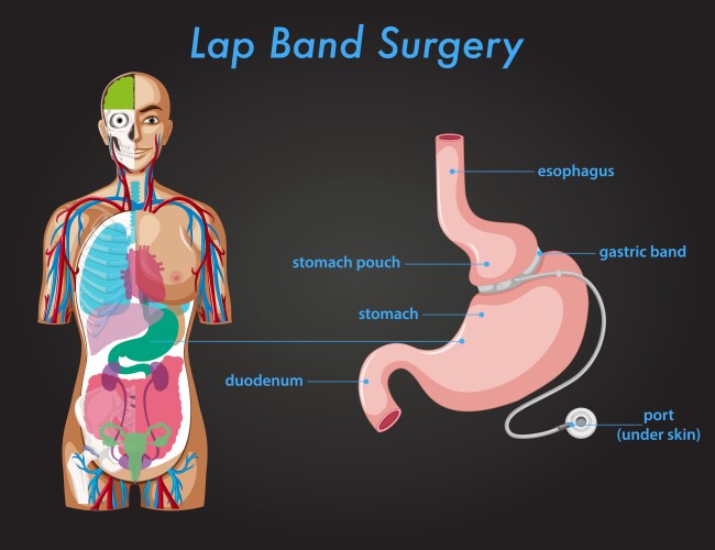 Surgery Vector Images (over 87,000)