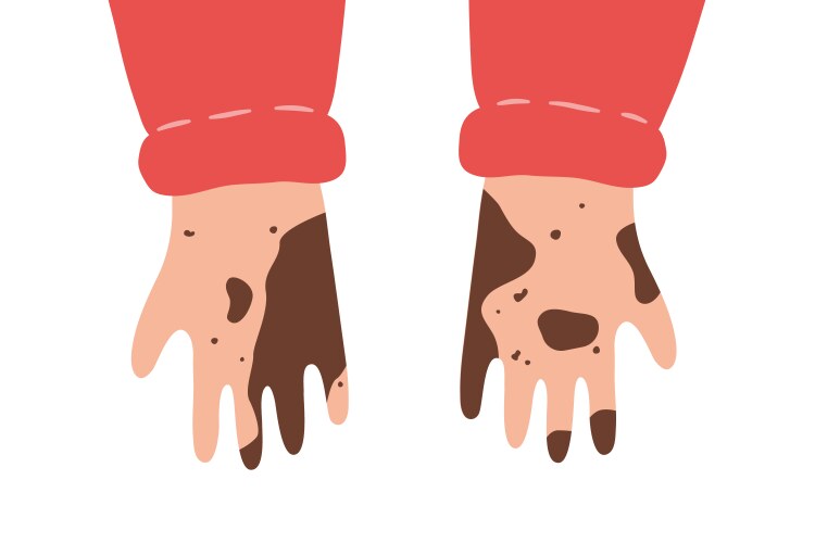 Dirty hand Royalty Free Vector Image - VectorStock