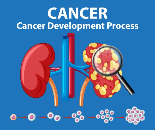 Cartoons Kidney Vector Images (over 4,100)