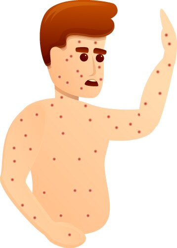 Chickenpox Cartoon Virus Vector Images (over 140)