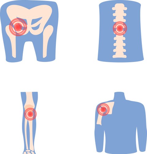 Joint Pain Cartoon Vector Images (over 1,500)