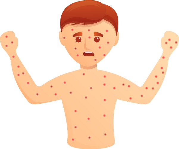 Fungal diseases skin Royalty Free Vector Image