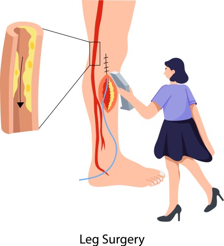Orchidectomy surgery Royalty Free Vector Image