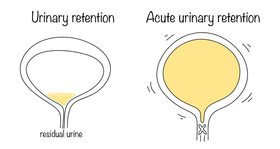 Urinary Incontinence Icon Vector Images (over 370)