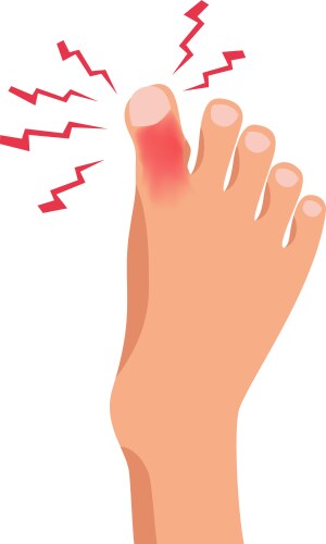 Foot Royalty Free Vector Image - VectorStock