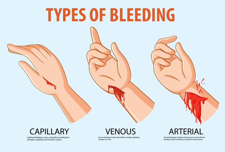 Bleeding Vector Images (over 10,000)