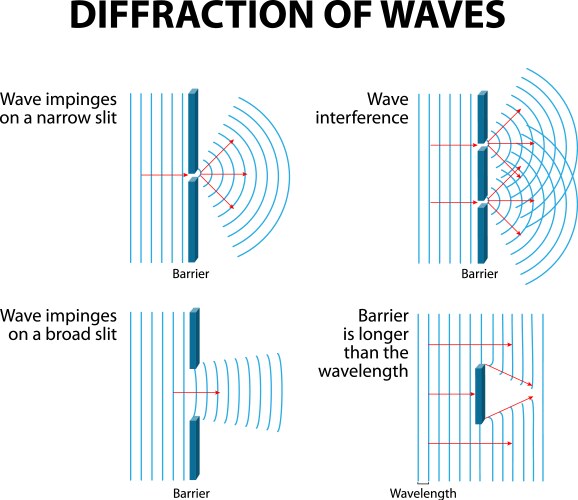 Periodontitis Royalty Free Vector Image - VectorStock