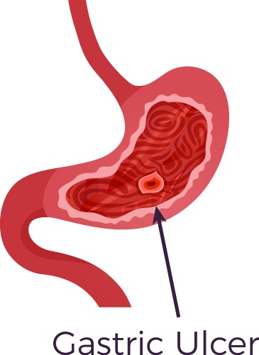 Gastric Vector Images (over 6,900)