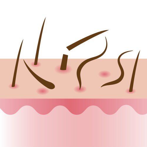 Scalp Vector Images (over 5,300)