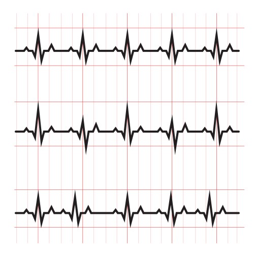 Ecg Vector Images (over 17,000)