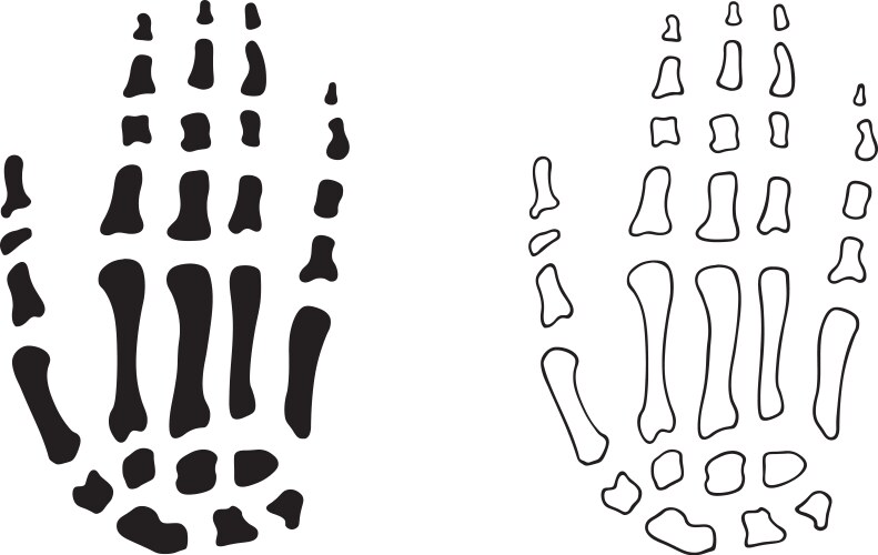 Bones Of The Hand