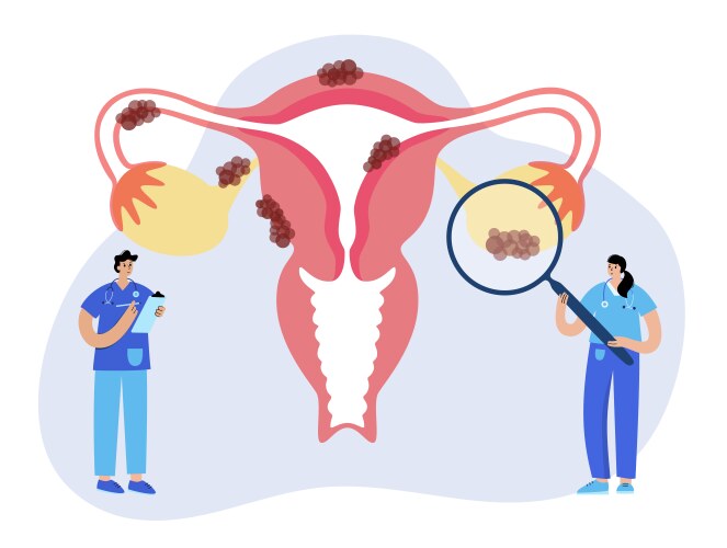Cervical Cancer Cervix Vector Images (over 330)