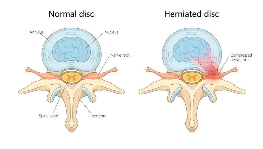 Spinal Column Vector Images (over 1,100)