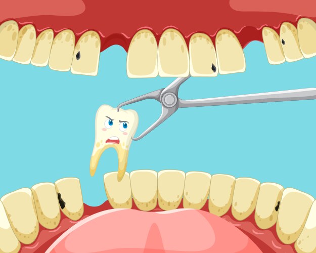 Tooth Extraction Cartoon Vector Images (over 300)