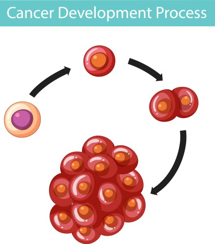 Cancer development process infographic Royalty Free Vector