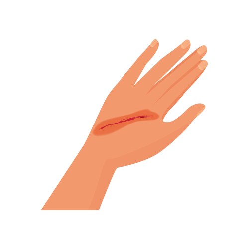 Wound Open Blood Vector Images (90)