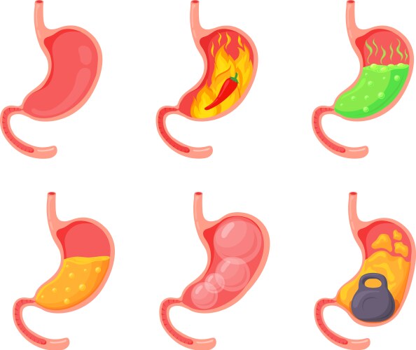Empty Stomach Vector Images (over 310)