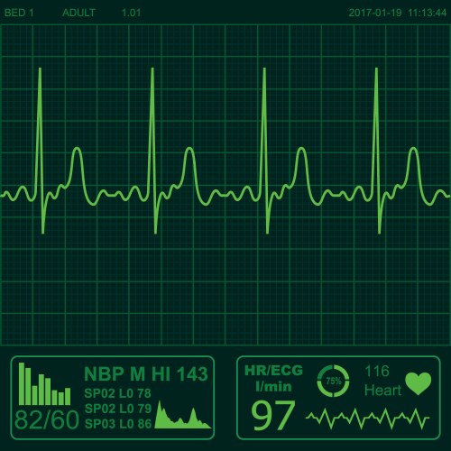 Green heart beat ekg graph eps 8 Royalty Free Vector Image