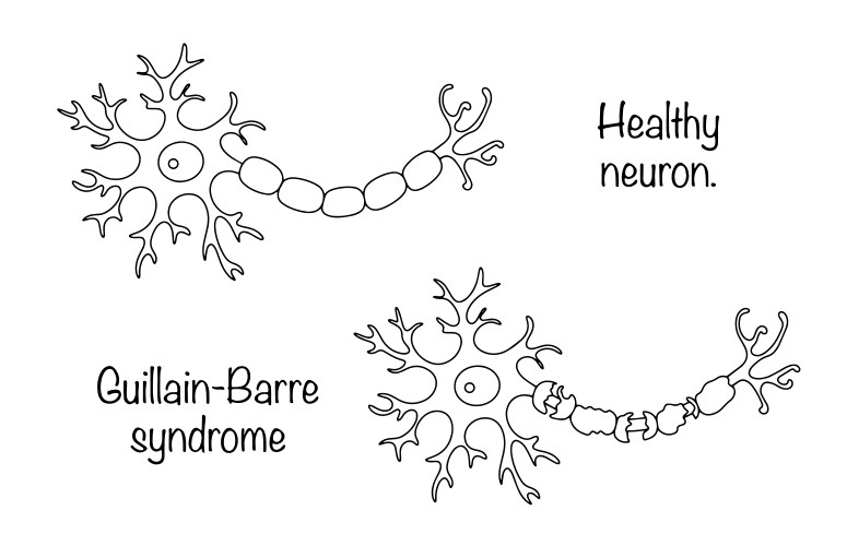 Tingling Vector Images (over 370)