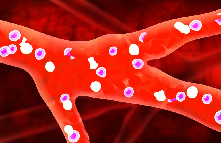 Arteries with clogged fat that causes blood clots Vector Image