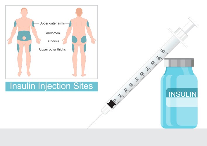 Insulin Injection Sites Vector Images (46)
