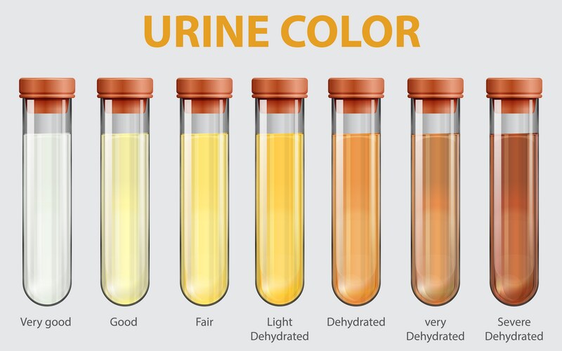 Urine Color Chart - Medical Guide – Royalty-Free Vector | VectorStock