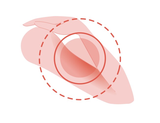 Elbow Cartoon Vector Images (over 1,200)