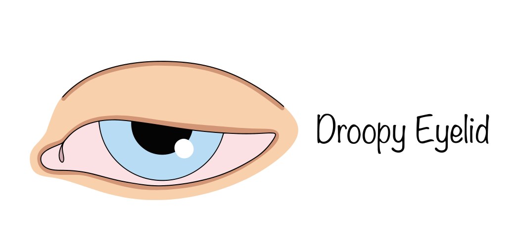 Droopy Vector Images (over 190)