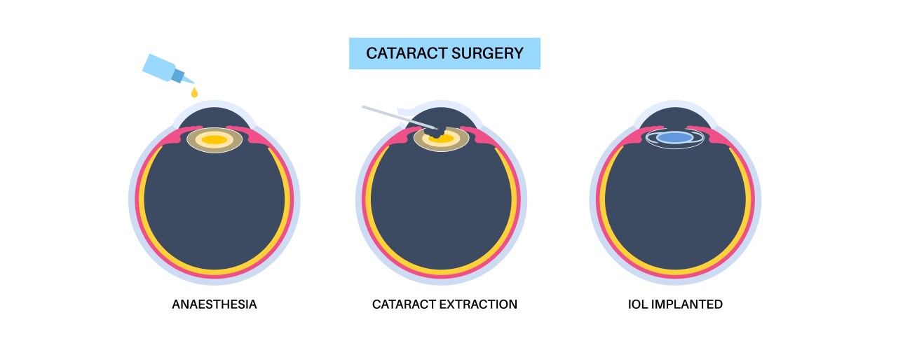 Surgery Vector Images (over 97,000)