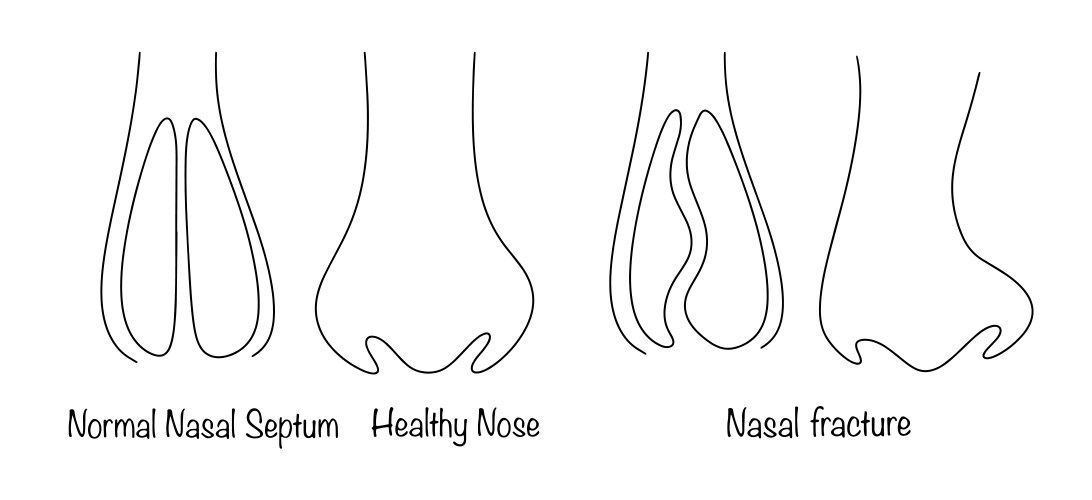 Nose Vector Images (over 88,000)