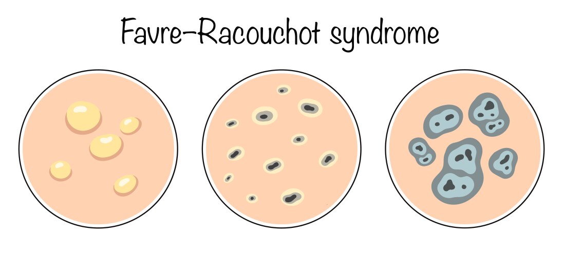 Dermatology Infographic Vector Images (over 4,200)