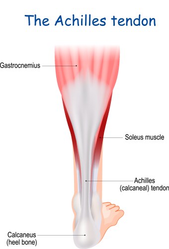 Medical infographic achilles tendon Royalty Free Vector