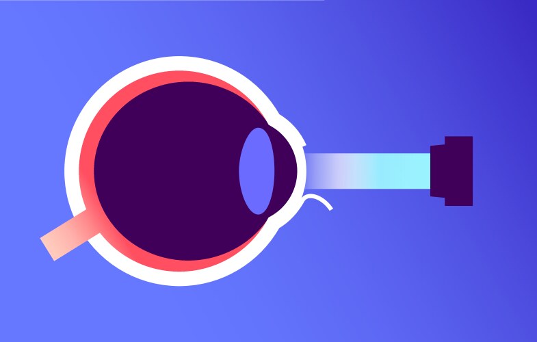 Lasik eye surgery Royalty Free Vector Image - VectorStock