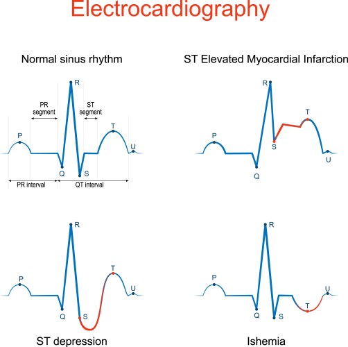 Ekg Vector Images (over 11,000)
