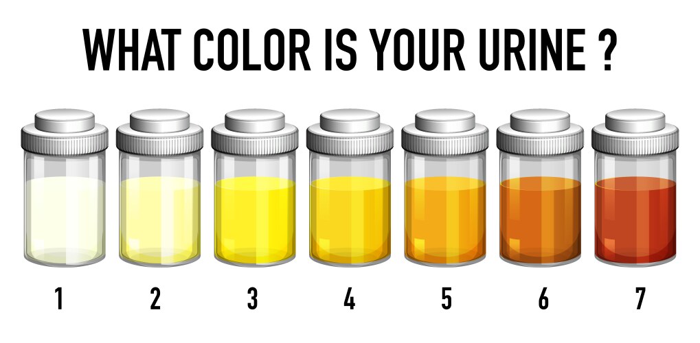 Urine Color Chart - Medical Guide – Royalty-Free Vector | VectorStock